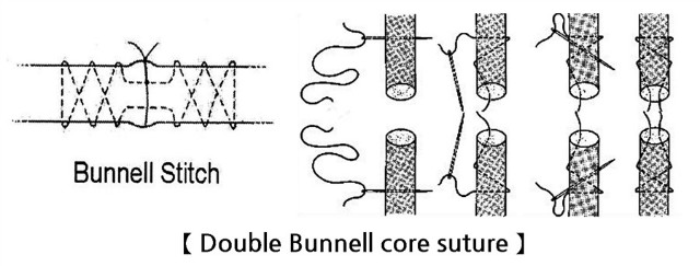 마디사랑병원 - Community > Blog
